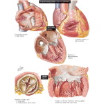 Nonpenetrating Heart Wounds