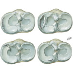 Disorders of the Knee