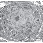 Comparative Views of the Ovary As Seen With Electron Microscopes