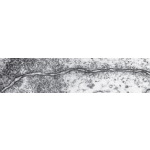 Electron Micrograph of Tight Junctions Between Two Epithelial Cells In ...