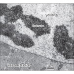 Electron Micrograph of a Satellite Cell In Skeletal Muscle In the ...