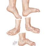 Foot Deformities