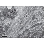 Electron Micrograph of Intermediate Filaments In a Cultured Cell