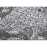 Electron Micrograph of Microtubules In the Cytocentrum