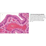 Light Micrograph of the Inner Lining of the Gallbladder
