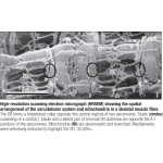 High-Resolution Scanning Electron Micrograph (HRSEM) Showing the ...