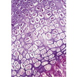 Light Micrograph Showing Details of the Growth Plate In Longitudinal ...