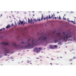 Light Micrograph of Part of a Bony Trabecula In Fetal Spongy Bone