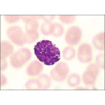 Light Micrograph of a Basophil In a Blood Smear