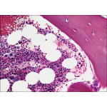 Light Micrograph Showing the Architecture of the Bone Marrow