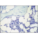 Light Micrograph Showing the Architecture of the Bone Marrow