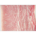 Light Micrograph of the Atrial Wall