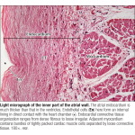 Light Micrograph of the Inner Part of the Atrial Wall