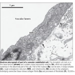 Electron Micrograph of Part of a Vascular Endothelial Cell