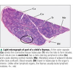 Light Micrograph of Part of a Child's Thymus