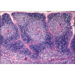 Light Micrograph of Part of a Child’s Thymus