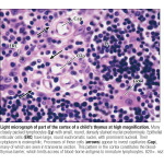 Light Micrograph of Part of the Cortex of a Child’s Thymus at High ...