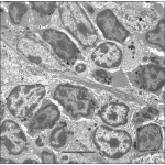 Higher Power Light Micrograph of Red Pulp