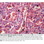 Higher Power Light Micrograph of Red Pulp