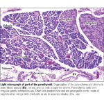Light Micrograph of Part of the Parathyroid