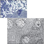 Light Micrograph of the Junction Between Adrenal Cortex and Medulla ...