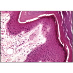 Light Micrograph of Thick Skin at the Dermoepidermal Junction
