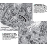 Electron Micrograph of a Parietal Cell In a Gastric Gland With Electron ...