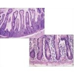 Light Micrograph of Part of the Ileum With Light Micrograph of the ...