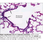 Higher Magnification View of a Respiratory Bronchiole