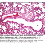 Light Micrograph of the Lung That Shows the Close Relationship Between ...