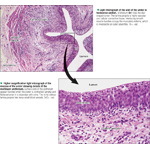 Light Micrograph of the Wall of the Ureter In Transverse Section With ...