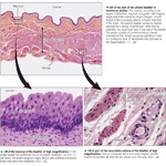 Light Micrograph of the Wall of the Urinary Bladder In Transverse ...