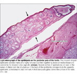 Light Micrograph of the Epididymis On the Posterior Pole of the Testis