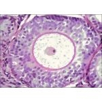 Light Micrograph of a Preantral Secondary Follicle
