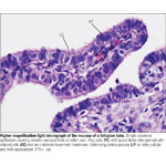 Light Micrograph of a Fallopian Tube at the Level of the Ampulla In ...