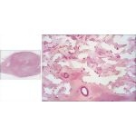 Low-magnification Light Micrograph of the Clitoris In Transverse ...