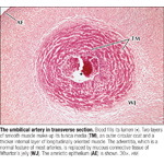 The Umbilical Artery In Transverse Section