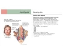 Cavernous Sinus Netter