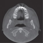 CT Image: Axial View