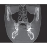 CT Image: Coronal View
