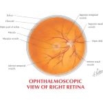 Ophthalmoscopic View of the Right Retina