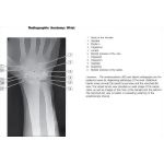 Radiographic Anatomy of the Wrist