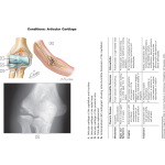 Articular Cartilage
