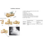 Calcaneus
