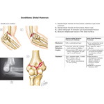Conditions: Distal Humerus