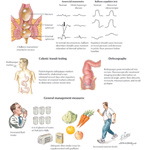 Diagnosis and Management of Constipation