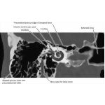 Inner Ear