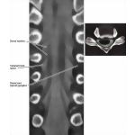 Spinal Cord, Nerve Roots