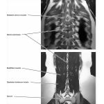 Deep Muscles of the Back