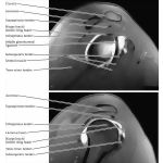 Shoulder Joint, Glenoid Fossa